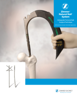 Zimmer® Natural Nail® System